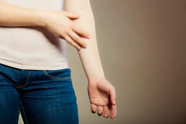 What Is A Stress Rash? - Causes, Symptoms & Treatments - Rest Equation